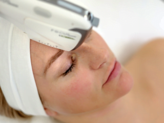 Focus Dual • Professional RF Microneedling & HIFU Device • Lynton