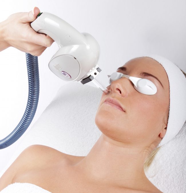 Pigmentation Removal Laser • Machines to treat Pigmentation