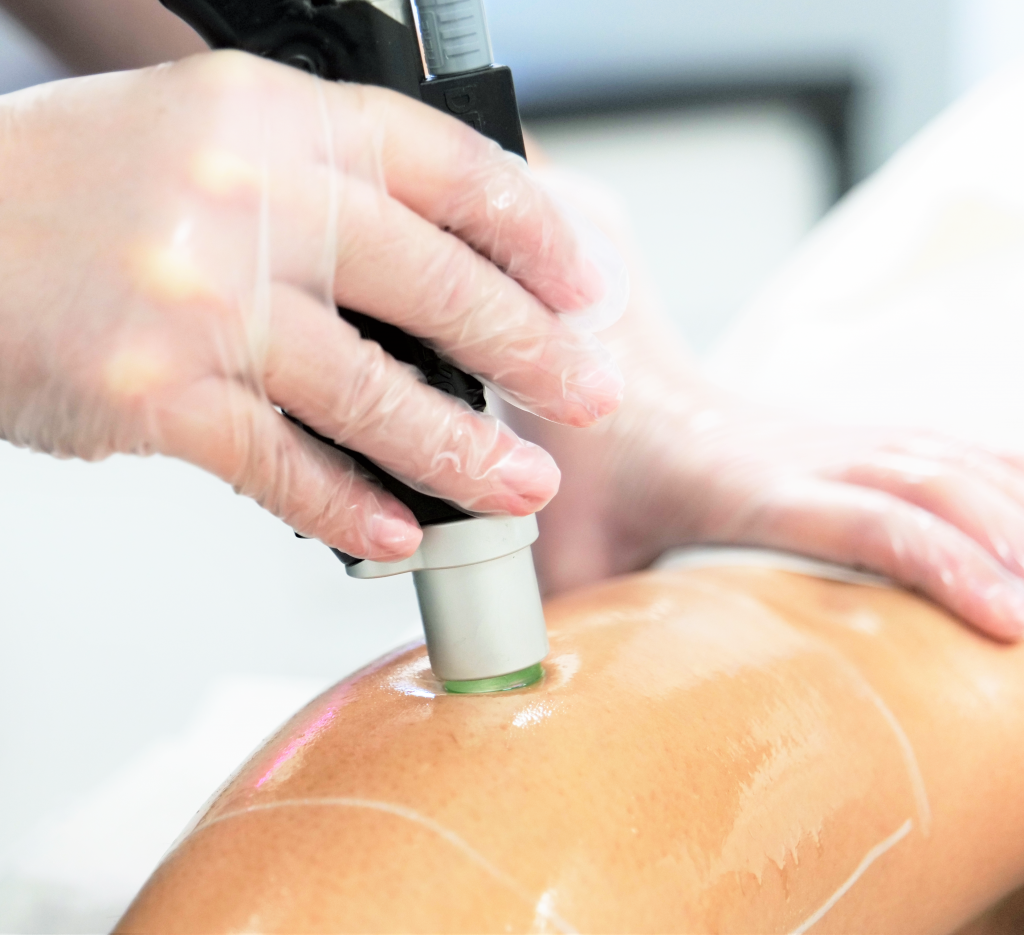 Professional Hair Removal Machines Laser & IPL • Lynton Lasers